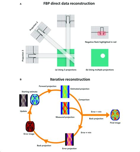 a simplified view of the direct fbp image reconstruction technique download scientific