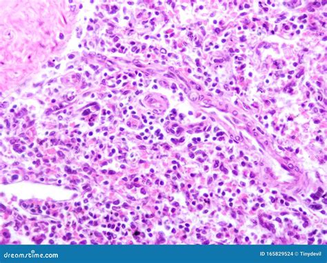 Histología Del Tejido Del Páncreas Humano Foto de archivo Imagen de