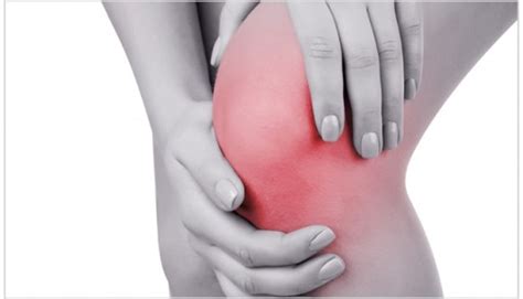 Condromalacia Rotuliana S Ntomas Y Tratamiento