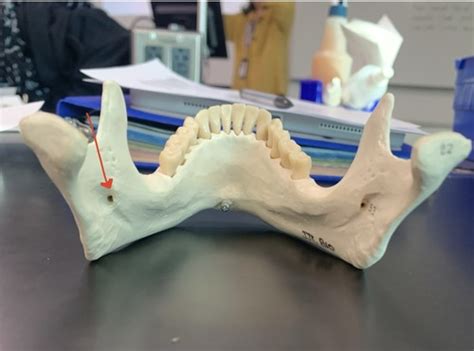 Flashcards Anatomy Lab Practical Bones Quizlet