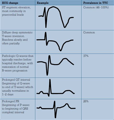 Takotsubo Cardiomyopathy Broken Heart Syndrome What Is It Broken