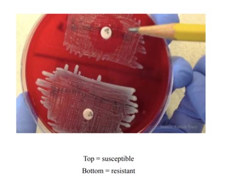 Microbio Lab Practical Flashcards Quizlet