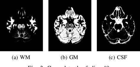 figure 3 from adaptively regularized kernel based fuzzy c means clustering algorithm using