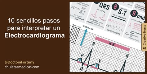 10 Sencillos Pasos Para Interpretar Un Electrocardiograma Chuletas