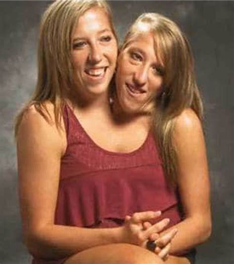 15 choses que vous ignorez sur les célèbres soeurs siamoises Abby et