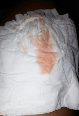 Topo 96 Imagem Sangue Rosa Gravidez Br Thptnganamst Edu Vn