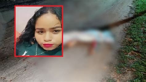 Not Cias Imagens Fortes Jovem De Anos Conhecida Como Terror