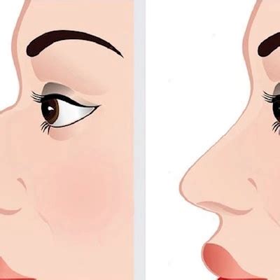 WHAT S THE DIFFERENCE BETWEEN COSMETIC SURGERY AND RECONSTRUCTIVE