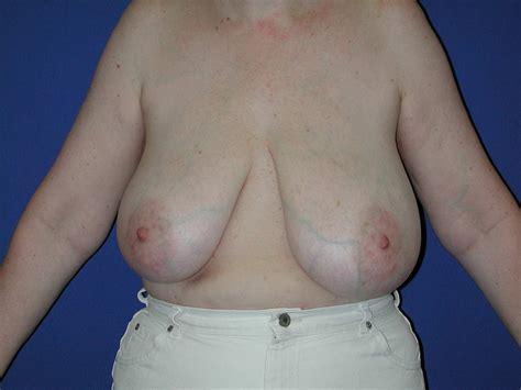 Hanging Saggy Boobs Telegraph
