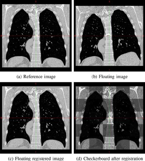 example of monomodal non rigid lung registration subject 25 3 emi download scientific
