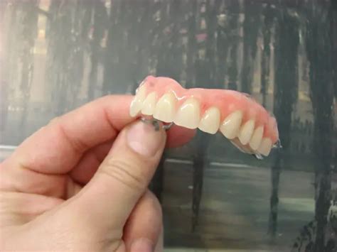 Prótese Dentária de Silicone Fixa Cultura Mix