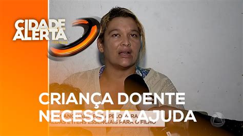 Mãe de bebê anomalia faz apelo para comprar fraldas e itens