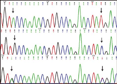 DNA Sequencing Chromatograms Homozygote 2365A And Homozygote 2385T