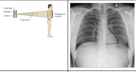 Intro To Radiology Flashcards Quizlet
