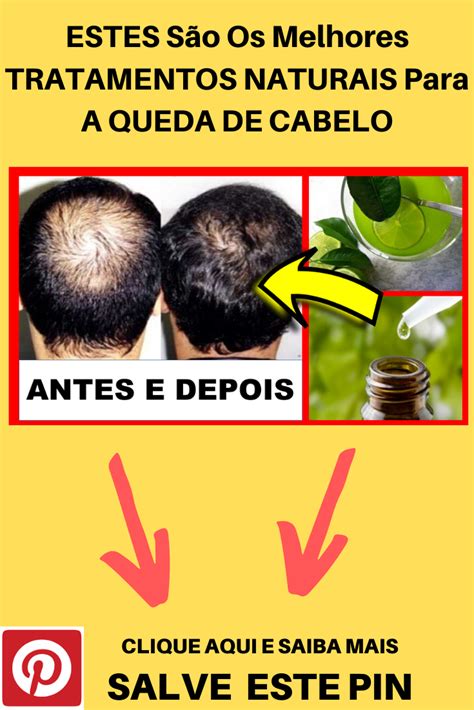 ESTES São Os Melhores TRATAMENTOS NATURAIS Para A QUEDA DE CABELO
