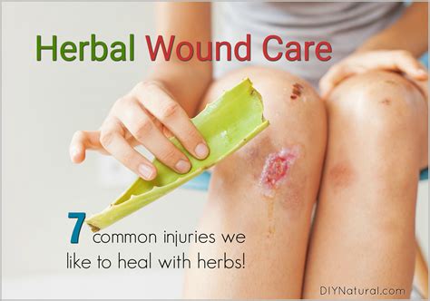 Healing Herbs For Wounds Liked Cuts Splinters Sprains And More