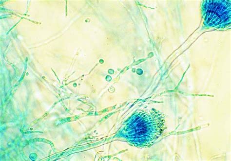 The Fungi Yeast And Molds Week 8 Flashcards Quizlet