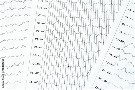 EEG Electrophysiological Monitoring Method EEG Wave In Human Brain