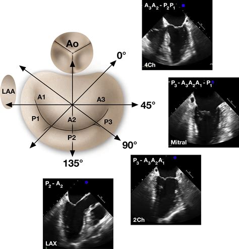 Guidelines For Performing A Comprehensive Transesophageal
