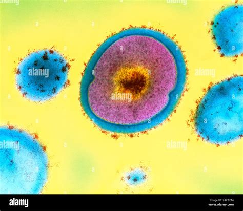 Staphylokokken Farbe Transmission Electron Micrograph Geschnittener
