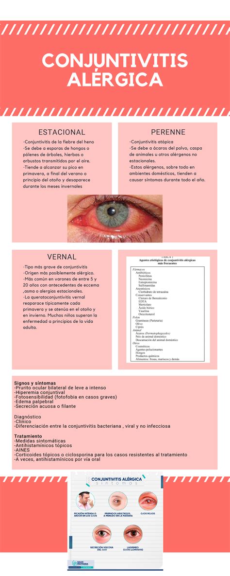 Infografia Conjuntivitis Alergica CONJUNTIVITIS ALÉRGICA ESTACIONAL