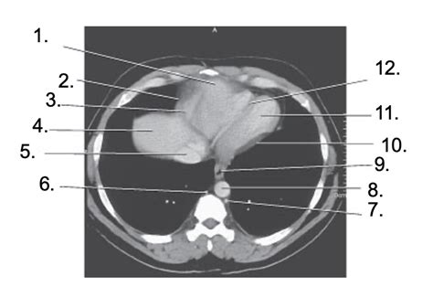 Abdomen Ct Image Diagram Quizlet