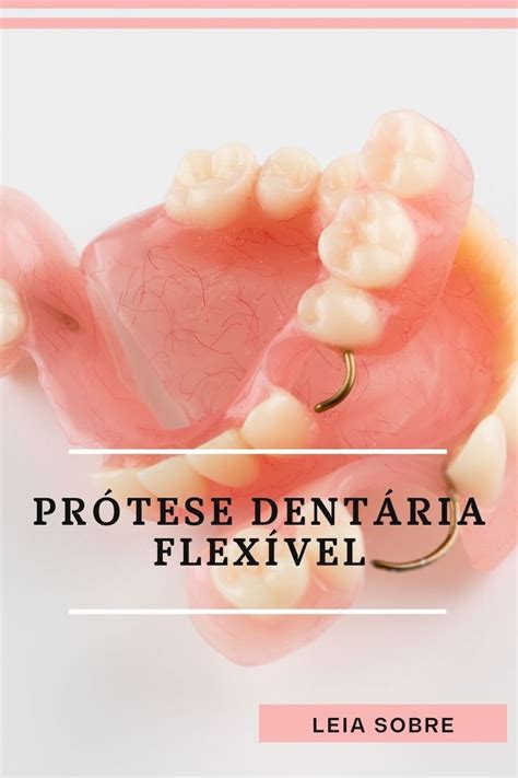 Prótese dentária flexível quando é indicada e quais são suas vantagens