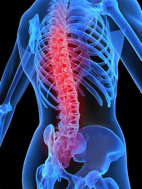 Omurga Cerrahisi Nedir Hangi Hastalıklara Bakar Medicana