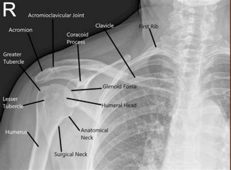 Msk Final Imaging Flashcards Quizlet