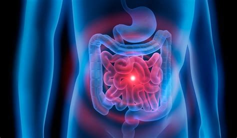 Chronisch entzündliche Darmerkrankungen Gastroenterologie Lusanum