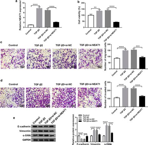 Effect of TGF β2 and NEAT1 knockdown on the progression of SRA01 04