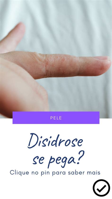 Disidrose entenda o que é e o que fazer Pele Doenças de pele Odor