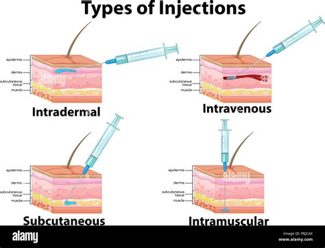 A Set Of Type Of Injections Illustration Stock Vector Image Art Alamy