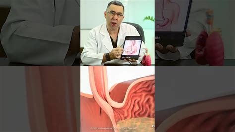 O que é Estoma 2023 Resolvido Ame Jumelle