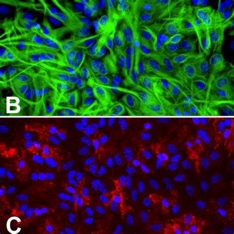 A Phase Contrast Image Of A Confluent Murine Primary Cortical Mixed