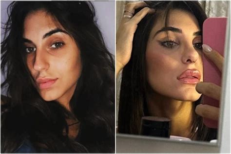 Gabriela Chieffo Prima E Dopo La Chirurgia Scansa Le Critiche Ero