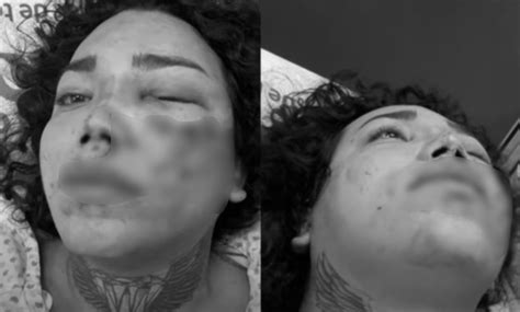 Paola Su Rez Influencer De Las Perdidas Hospitalizada La Golpe Su