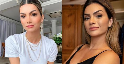 Kelly Key revela que tem psoríase e desabafa que sofre preconceito por isso