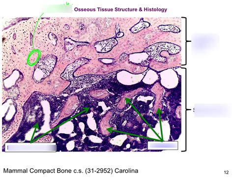 Compact Bone Spongy Bone Diagram Quizlet