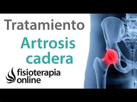 Ejercicios Automasajes Y Estiramientos Para El Tratamiento De La