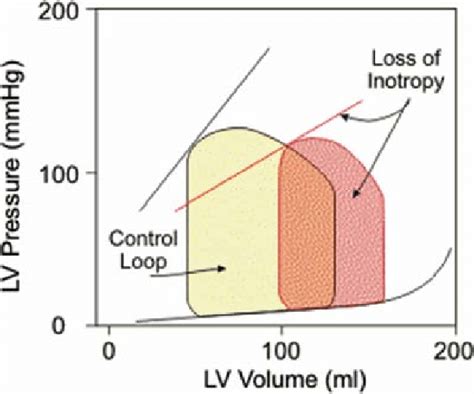 2 Normal And Systolic Failure Volume Loops The Control Loop