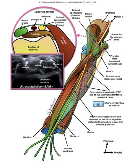 𝐃𝐫 𝐎𝐌𝐈𝐃 𝐁𝐀𝐍𝐃𝐀𝐑𝐂𝐇𝐈 𝐌 𝐃 on Twitter Lacertus Tunnel Syndrome a