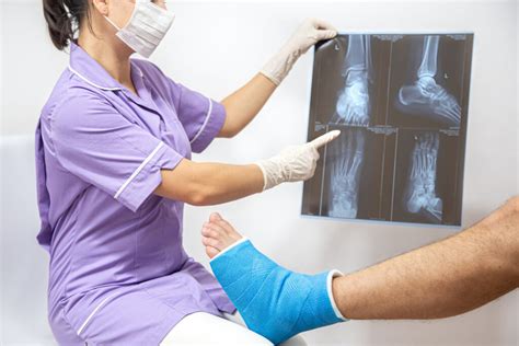 Todo Lo Que Debe Saber Sobre Las Fracturas Cerradas