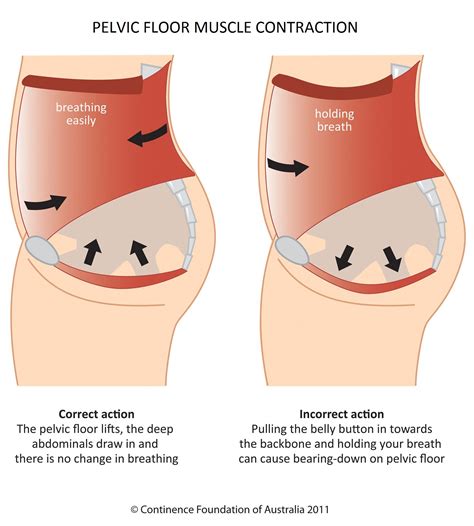 Cartoon Prolapse Telegraph