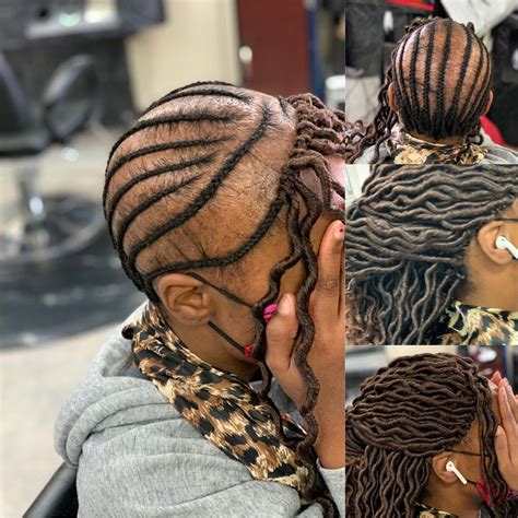 Alopecia Hairstyle Alopecia Hairstyles Alopecia Hair Styles