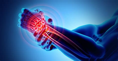 Hand Wrist Arthritis Symptoms Diagnosis Treatment Medstar Health