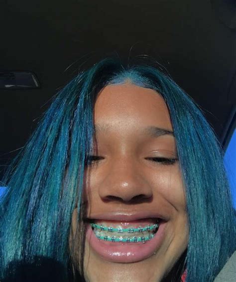 Cute Braces Colors For Light Skins Warehouse Of Ideas
