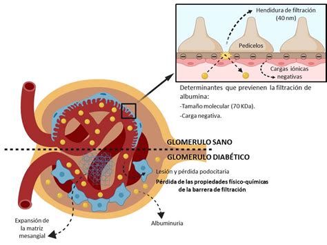 Albuminuria Diabetes