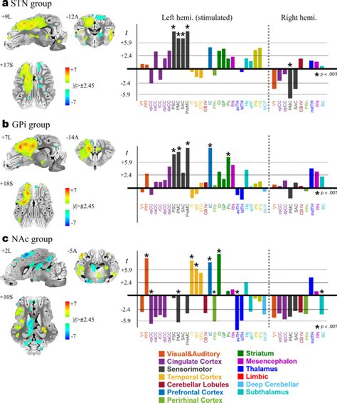 multivariate pattern classification on bold activation pattern induced by deep brain stimulation