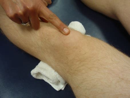 Knee Palpations Flashcards Quizlet